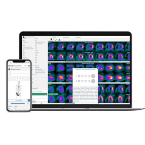Nuclear Medicine - Axim